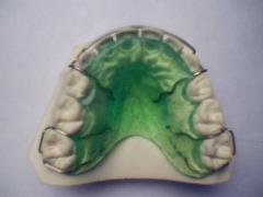 RETENEDOR TIPO HAWLEY